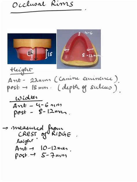 Complete Denture Notes Extooth Complete Denture Notes Extooth