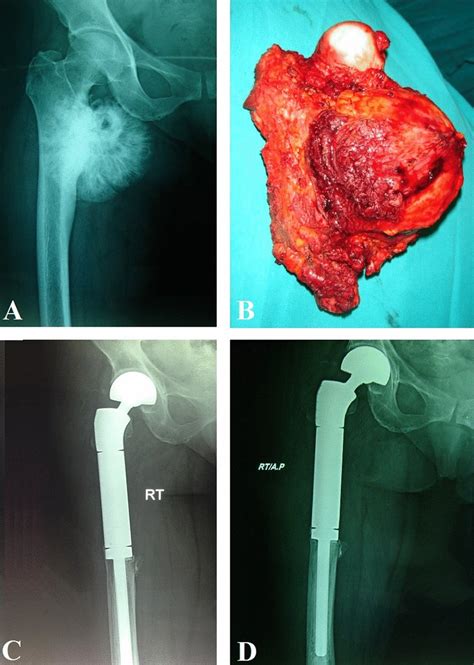 A Case Of A Female Patient Patient N 9 47 Years Old With Right Download Scientific Diagram