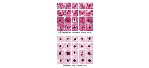 Mitosis Detection Using Deep Learning