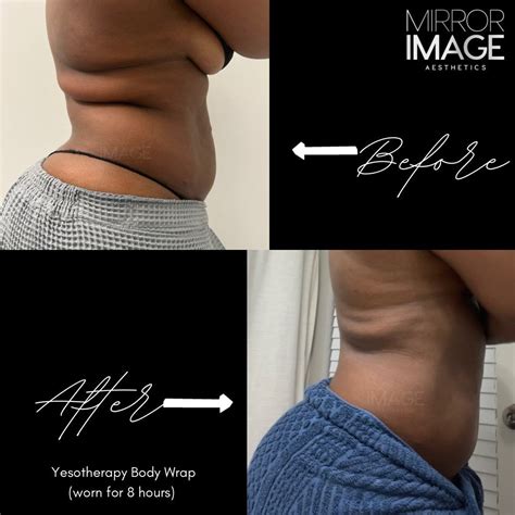 Yeso Body Wraps Slimming Body Wrap Fat Reduction Body Wrap Wholesale