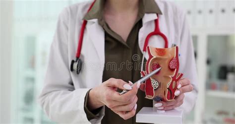 Doctor Shows Diseases Of Rectum On Artificial Model Of Human Organ Stock Video Video Of