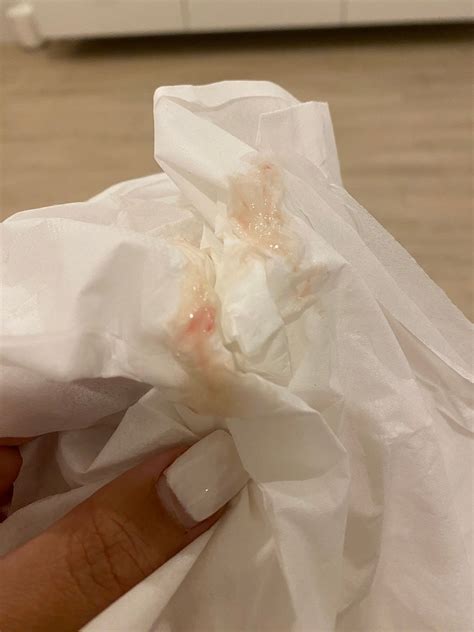Pink Discharge After Pooping At Phoebe Buck Blog