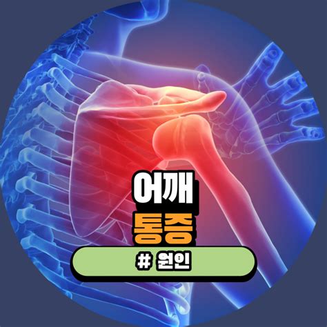 오른쪽 왼쪽 어깨 통증 원인 줄이는 방법 네이버 블로그