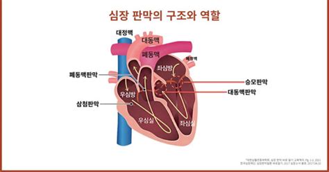 심장의 문 판막 오래 쓰면 닳아 이상 증상 알아두세요