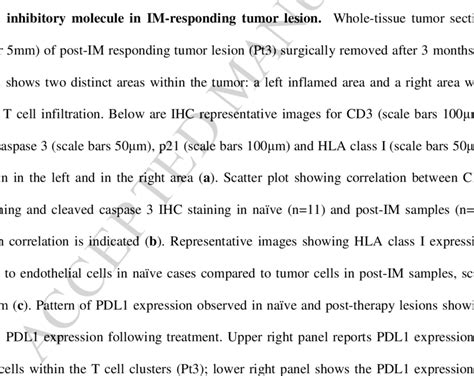 T Cell Mediated Apoptosis Of Tumor Cells And Up Regulation Of Hla Class