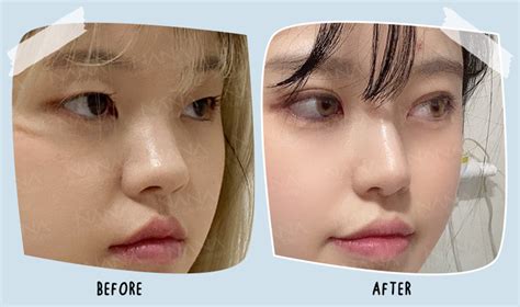 韓国美容韓国整形 Nana美容外科23年3月12日！東京現地相談会開催´艸` 【韓国整形・韓国美容】nana美容整形外科