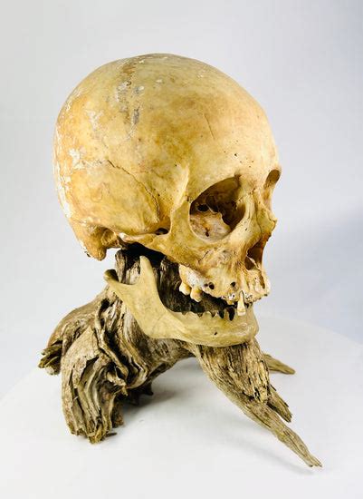 Antique Anatomical Skull Genuine Human Specimen On Wood Stand 19th