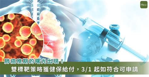 紅斑性狼瘡未控制恐面臨洗腎國衛院揪出免疫疾病關鍵致病機轉 Heho健康