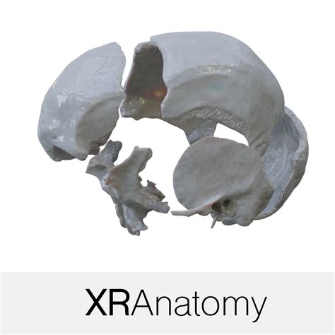 Mandibular Fossa Of Temporal Bone XR Anatomy