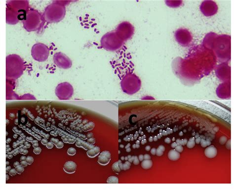 Pantoea Agglomerans Antibiotic Treatment