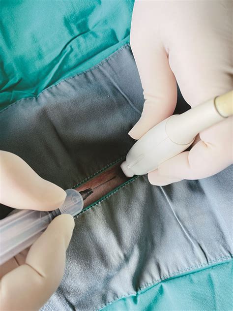 Ultrasound Guided Fine Needle Aspiration And Core Biopsy Todays Veterinary Practice