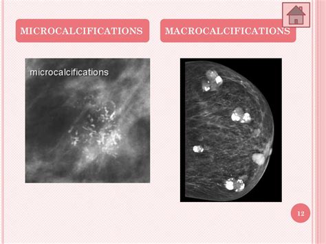 Softvue C Ppt Download