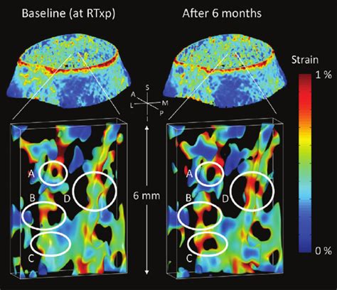 Comparison Of Strain Maps Obtained From Whole Bone Section Download Scientific Diagram