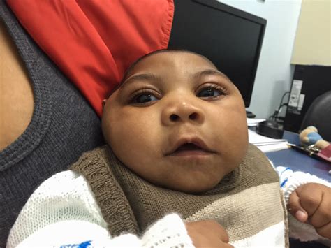 Zikavirus Lex
