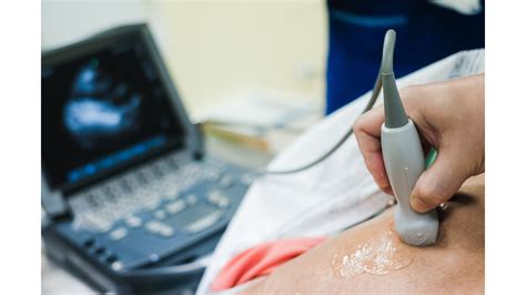 Understanding Your Echocardiogram James Kim Md James Kim Cardiology