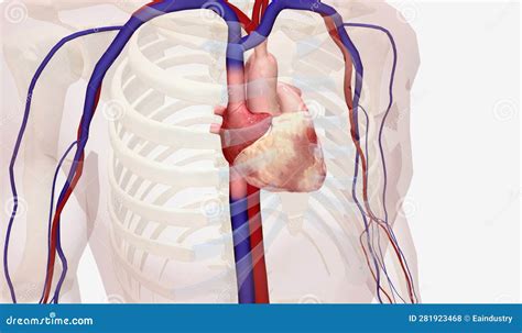 The Implantable Loop Recorder Placement Stock Illustration