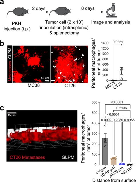 Gata6 常驻腹腔巨噬细胞促进肝转移瘤的生长 Nature Communications X Mol