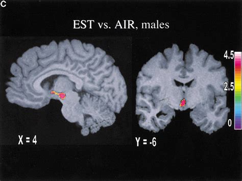 Smelling Of Odorous Sex Hormone Like Compounds Causes Sex