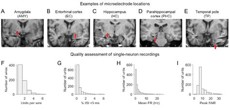 Fig S6 Single Neuron Recordings Anatomical Locations And Quality Download Scientific Diagram