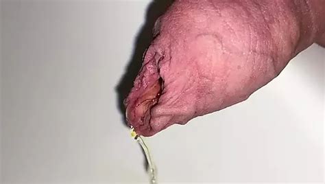 Close Up Edging Tight Foreskin With Big Cockhead Gay Xhamster