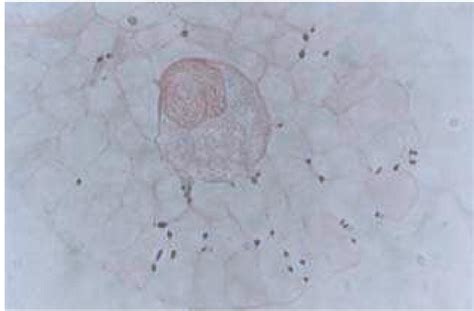 Figure 3 From Streptococcus Suis