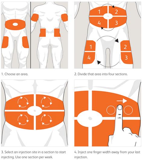 Draait U Uw Injectieplaatsen Frio