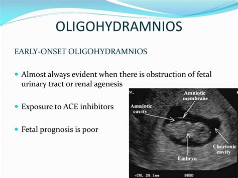 Ppt Lecture 18 Abnormalities Of Fetal Membranes And Amniotic Fluid Powerpoint Presentation Id