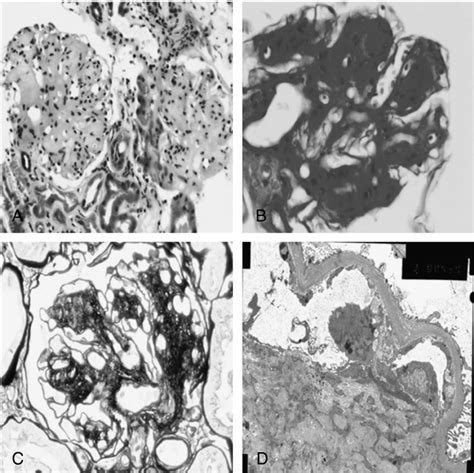 A Haematoxylin And Eosin Stained Section Demonstrating Increased