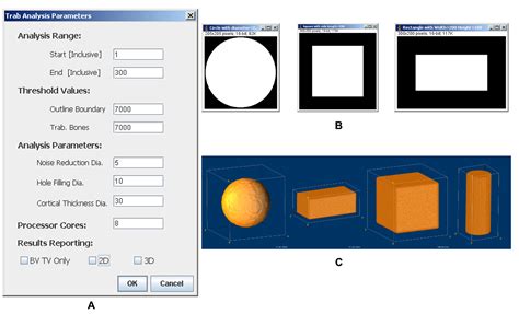 Outer Boundary Assisted Segmentation And Quantification Of Trabecular