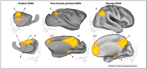 Figure 1 From Functional Magnetic Resonance Imaging Of Intrinsic Brain Networks For