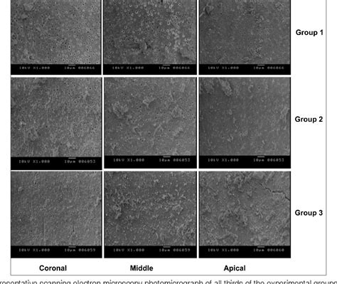 Figure 2 From Comparative Scanning Electron Microscopy Evaluation Of