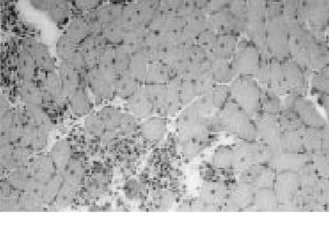 Figure 1 From Histological Study Of Masseter Muscle In A Mouse Muscular