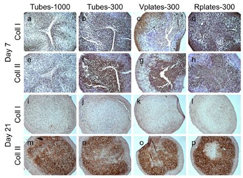 Immunohistochemical Staining DAB For Collagen I And II At Days 7 And