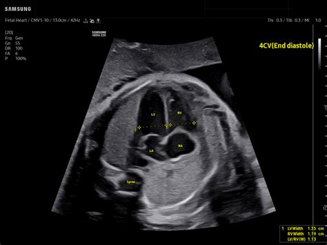 Images Thesuite Learn Without Limits