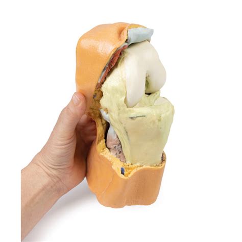 3d Printed Flexed Knee Joint Deep Dissection Model 3d Printed Flexed