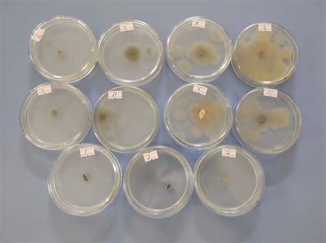 Emil Rəhimli On Linkedin Microbiology Chemistry Biochemistry