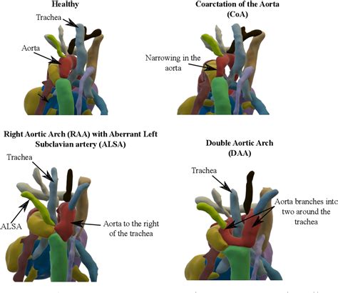 Figure 2 From Multi Task Learning For Joint Weakly Supervised