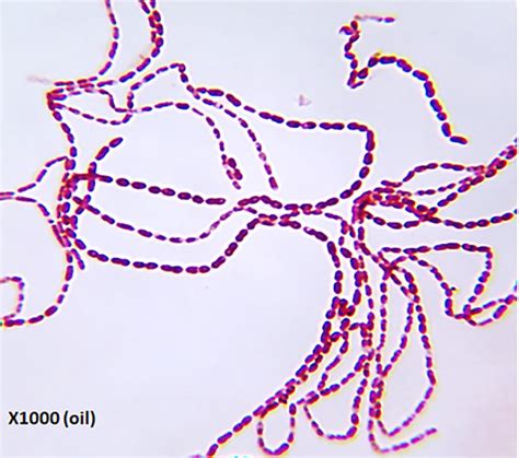 Complete Genome Sequence Of Moraxella Osloensis Strain Yv1 Isolated