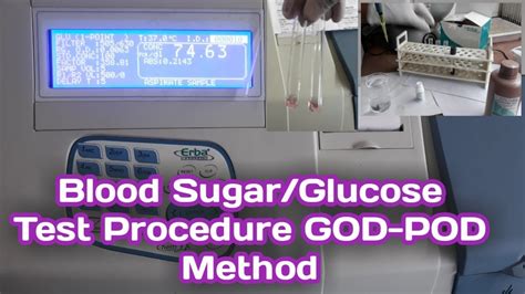 Glucose Lab Test Cpt At Steve Stults Blog