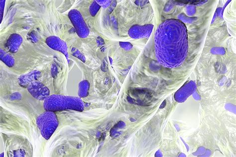 What is Biofilm? Evolution, Assessment, and Treatment - Sanara MedTech