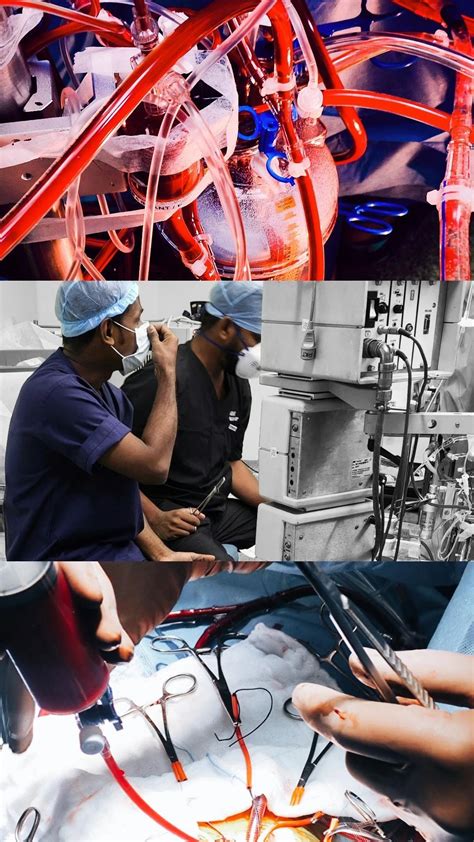 Perfusionist Ecmo Cardiacperfusionist Americanheartassociation