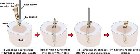 Schematic Illustration Of Implanting Ultraflexible Neural Probe Into