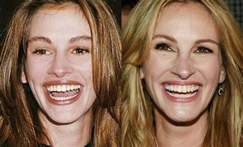 Ok “მისი ღიმილი 55 წლის ასაკშიც თვალისმომჭრელია” ჯულია რობერტსი Critics Choice Awards ის