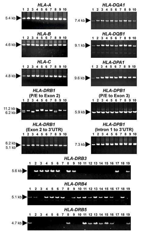 in phase hla genotyping by next generation sequencing — a comparison