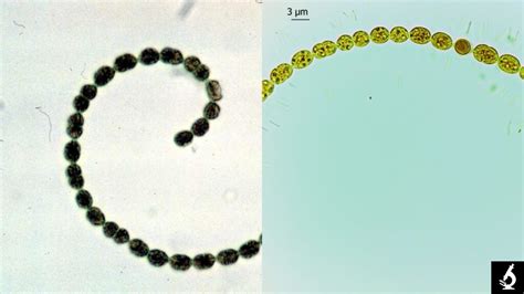 Anabaena Definition Structure Reproduction Importance Biology Notes Online
