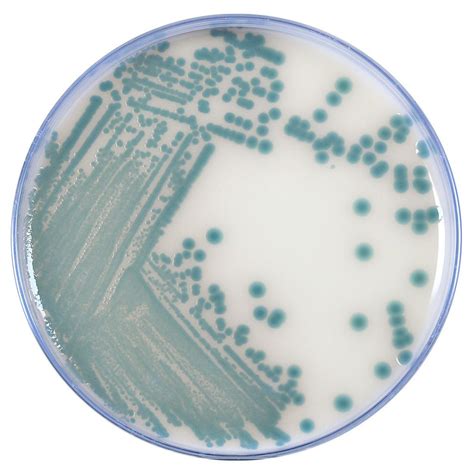 Hardychrom™ Vibrio Chromogenic Medium Pre Poured Ready Agar Plates 10 Pack Benotech