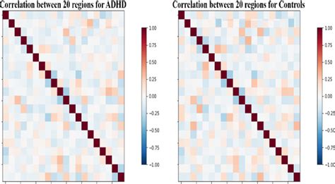 Figure 1 From Dnn Based Classification Of Adhd Fmri Data Using Functional Connectivity