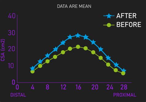 Overhead Extensions Vs Pushdowns For Triceps Hypertrophy Research House Of Hypertrophy