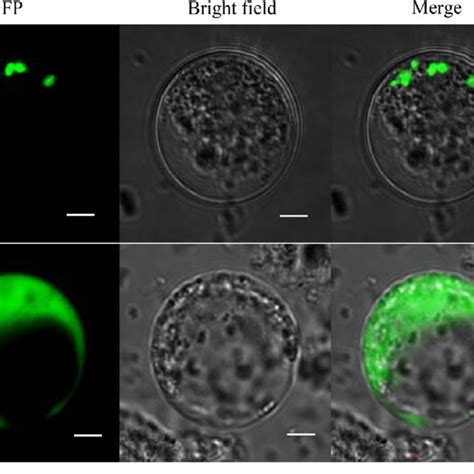Subcellular Localization Of Scd27 Gfp Fusion The Empty Pcambia1302 Download Scientific Diagram