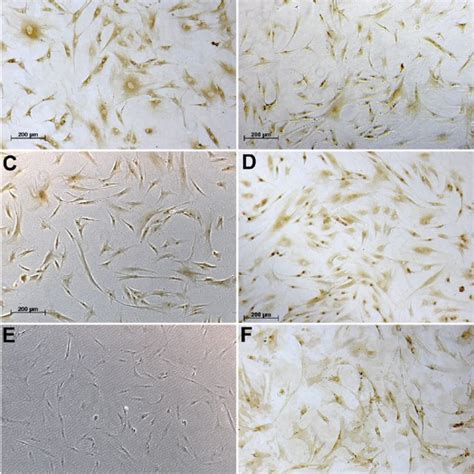 Immunohistochemical Staining Of Tenocyte Markers Biglycan A Runx